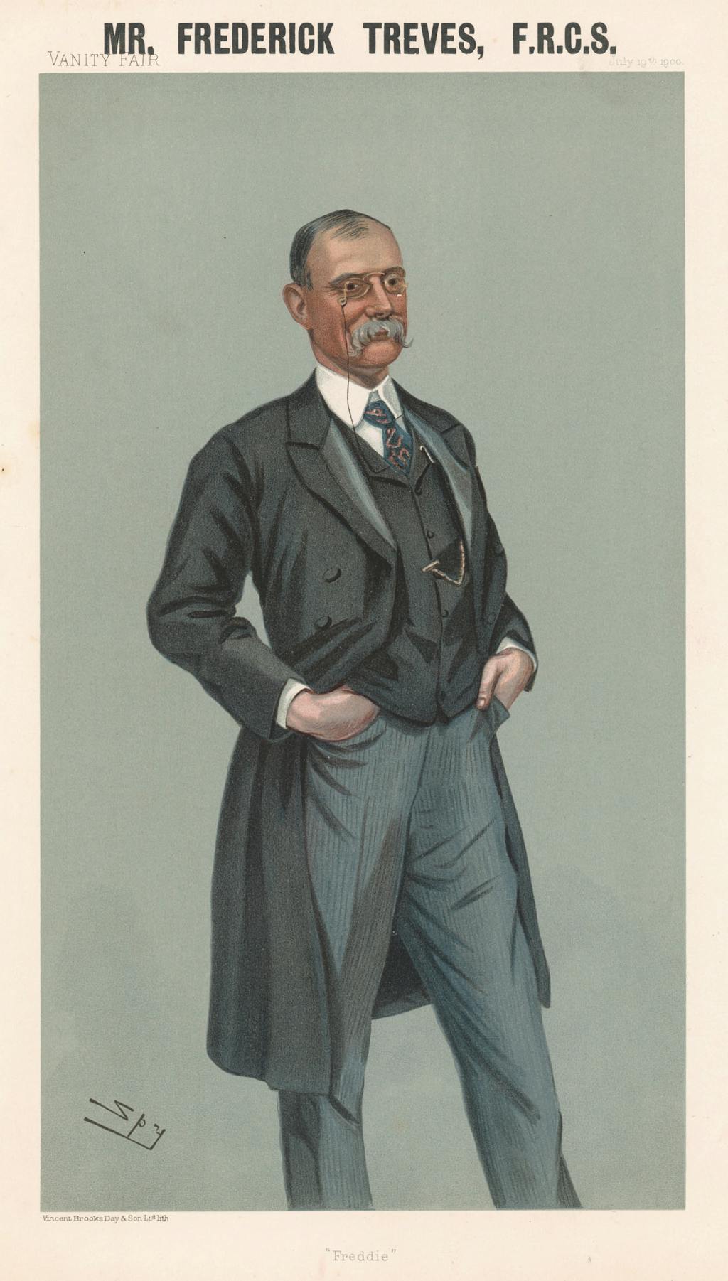 Elefantmannen fascinerade och förfärade | varldenshistoria.se