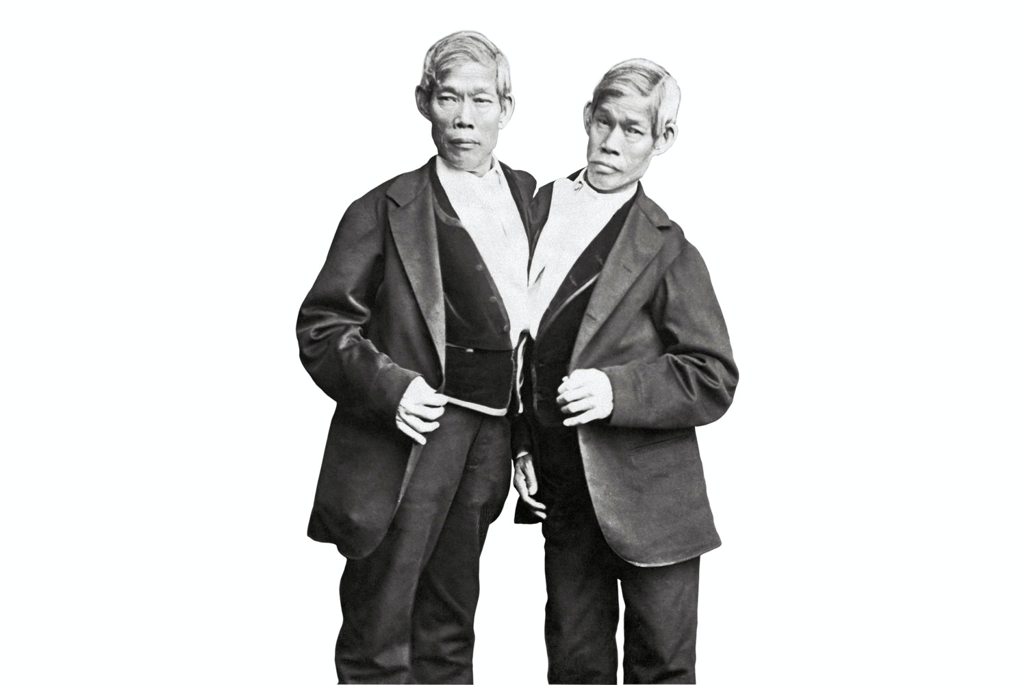 Deze ‘freaks’ werden wereldberoemd | historianet.nl