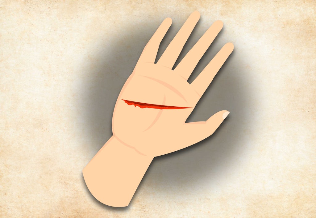 Besnijdenis moest geslachtsziekten genezen | Historianet.nl