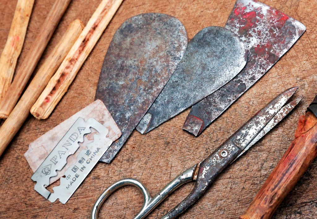 Besnijdenis moest geslachtsziekten genezen | Historianet.nl