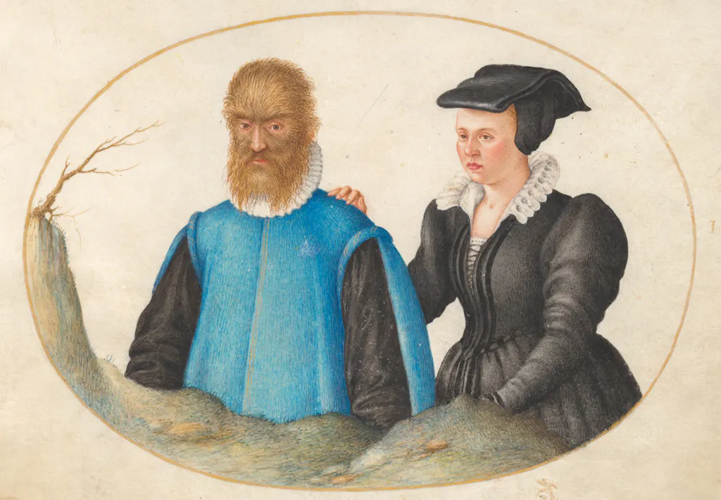 Het tragische verhaal van de echte ‘Beauty en Beast’ | historianet.nl