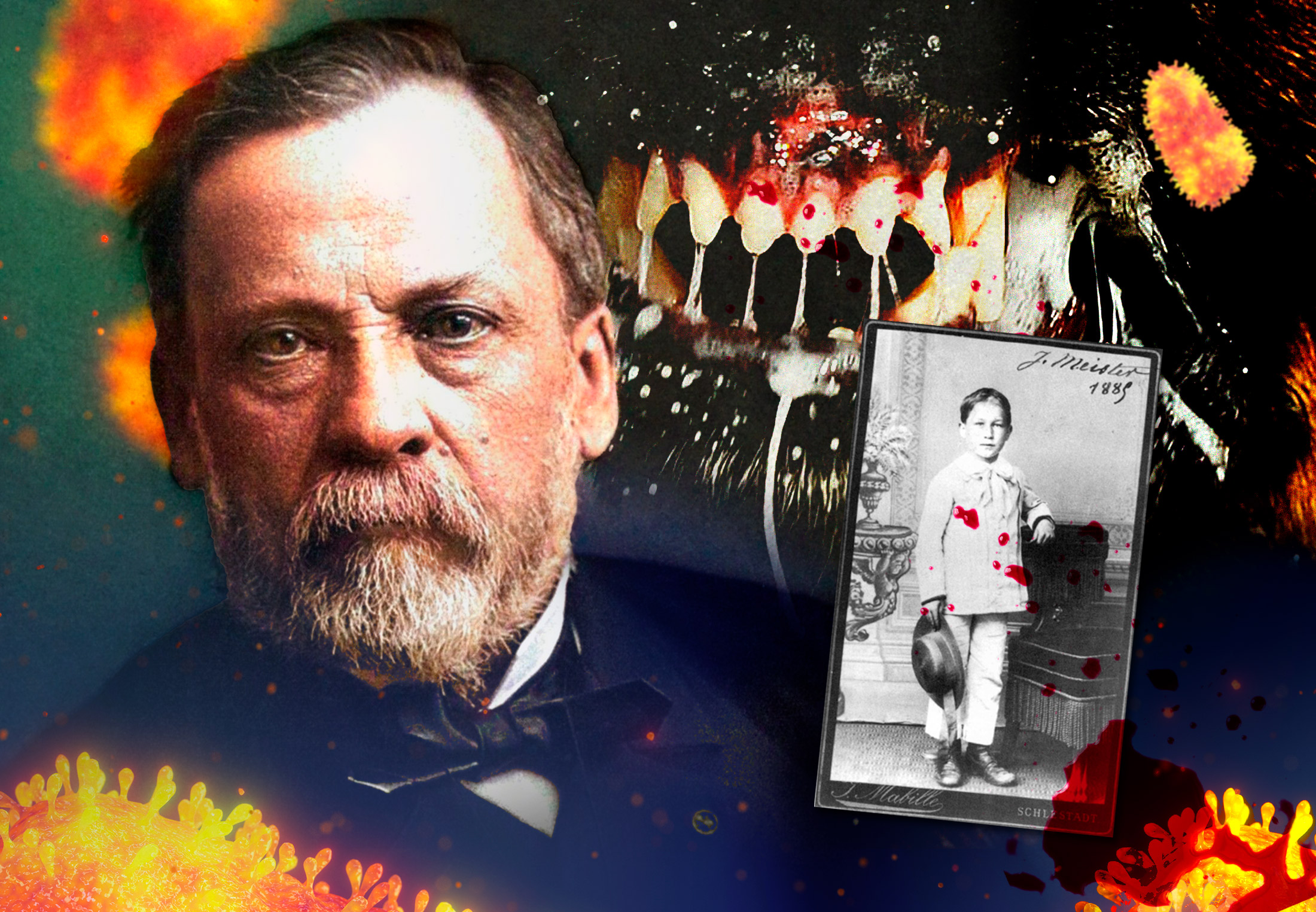 Rabies - sådan fandt Pasteur kuren mod hundegalskab | historienet.dk