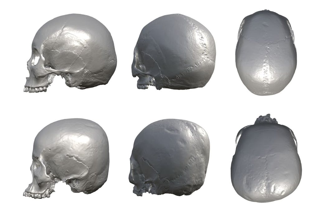 1700 jaar oud ritueel veranderde schedels van Japanse baby’s ...