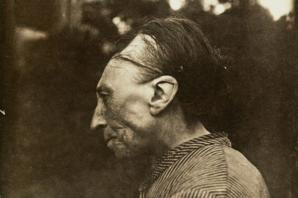 1700 jaar oud ritueel veranderde schedels van Japanse baby’s ...