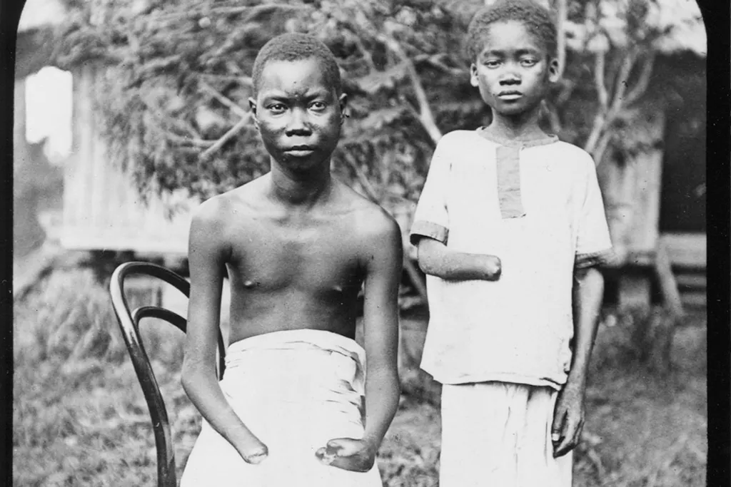 Fristaten Congo var Leopold 2.'s private arbejdslejr | historienet.dk