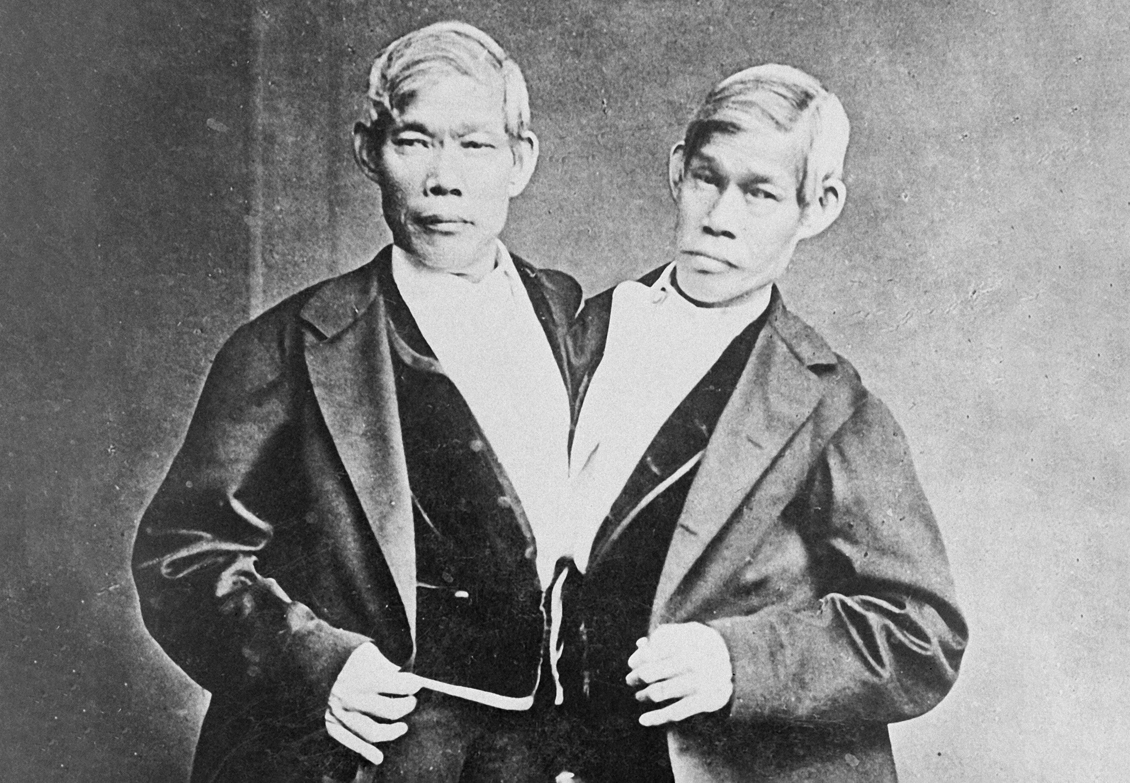 Het duistere verhaal achter de originele Siamese tweeling | historianet.nl