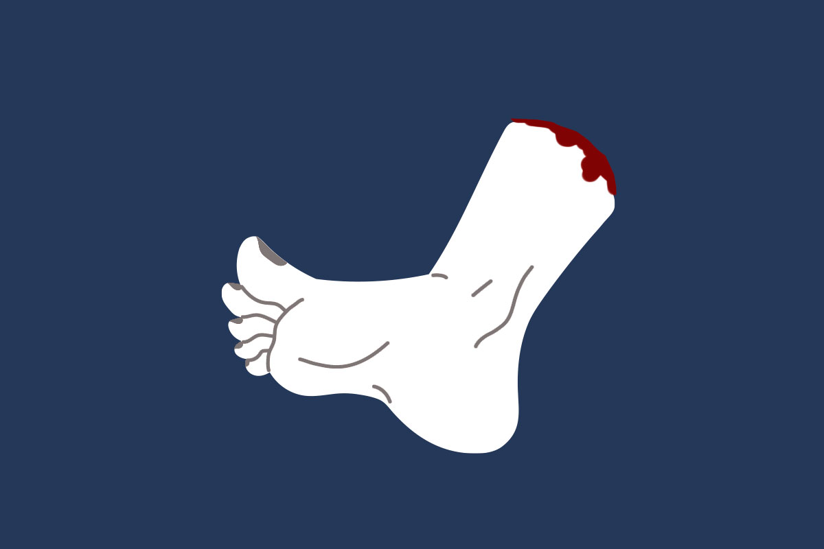 Tjenestepigen Katherine Webster parterede sin arbejdsgiver | historienet.dk