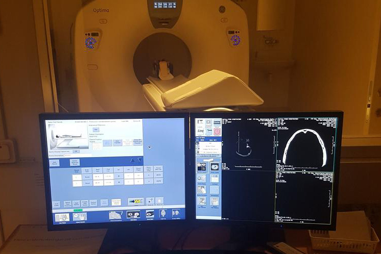 CT-scans onthullen verborgen Vikingziekten | historianet.nl
