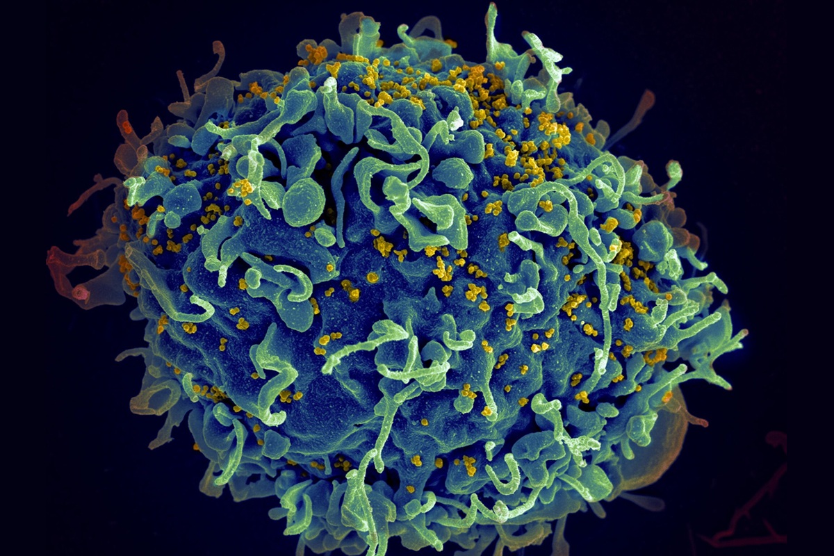 Stor studie: Här uppstod en speciell mutation som bekämpar HIV ...