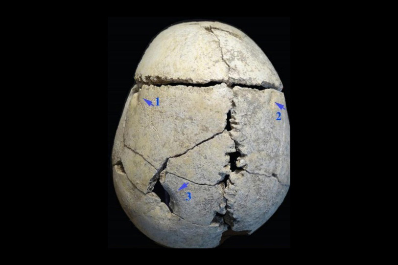 Jonge man werd 6200 jaar geleden gebeten door een leeuw. Volgens wetenschappers overleefde hij ...