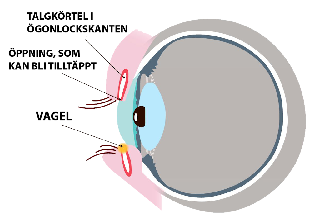 Vagel i ögat – varför får man det? | I FORM