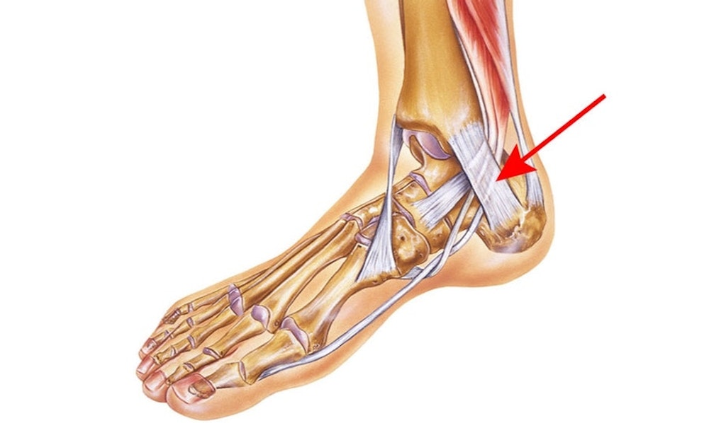 Så behandlar du en stukad fot | I FORM
