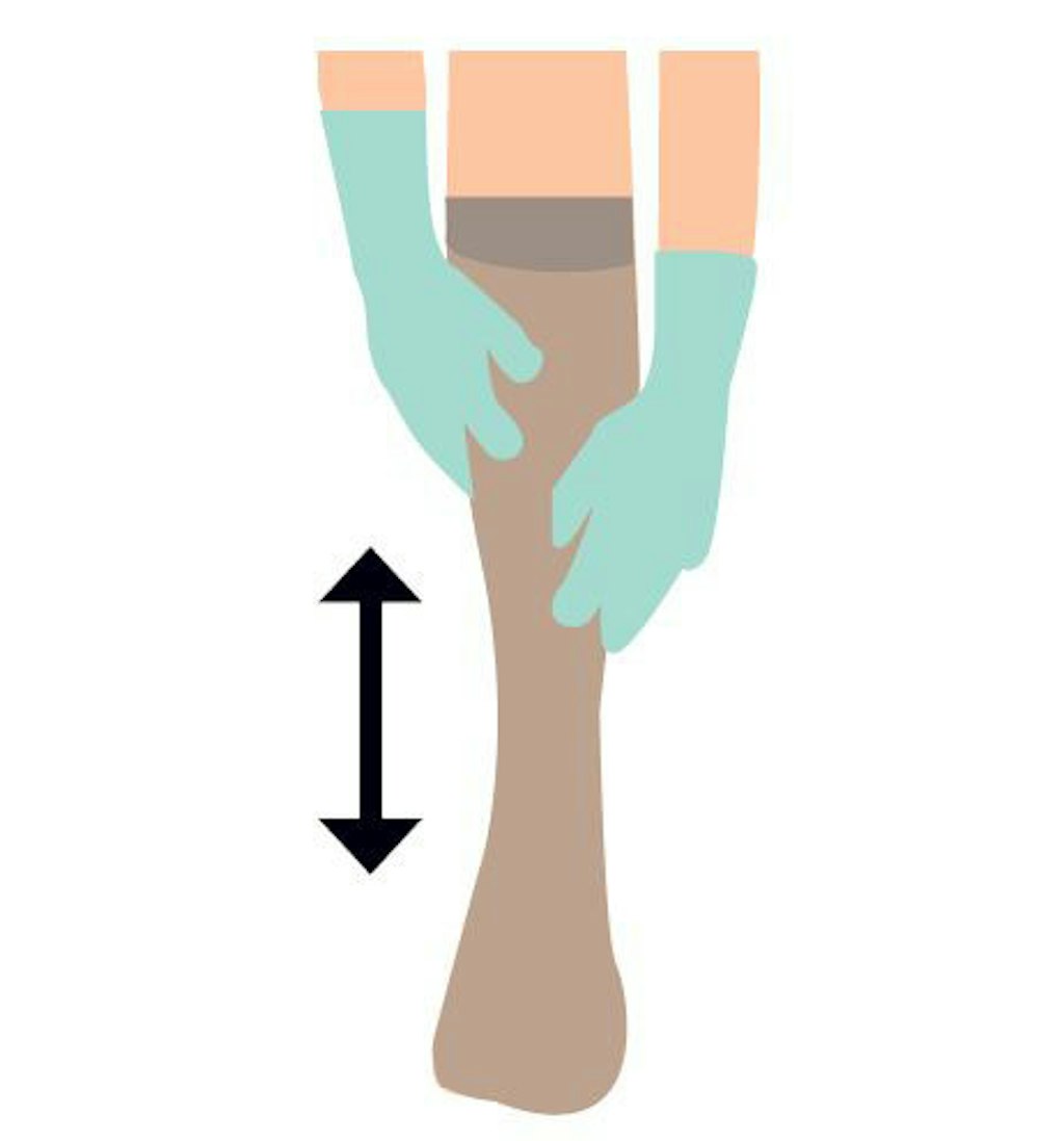 8 spørgsmål om blodpropper: Hvad er symptomerne? | I FORM