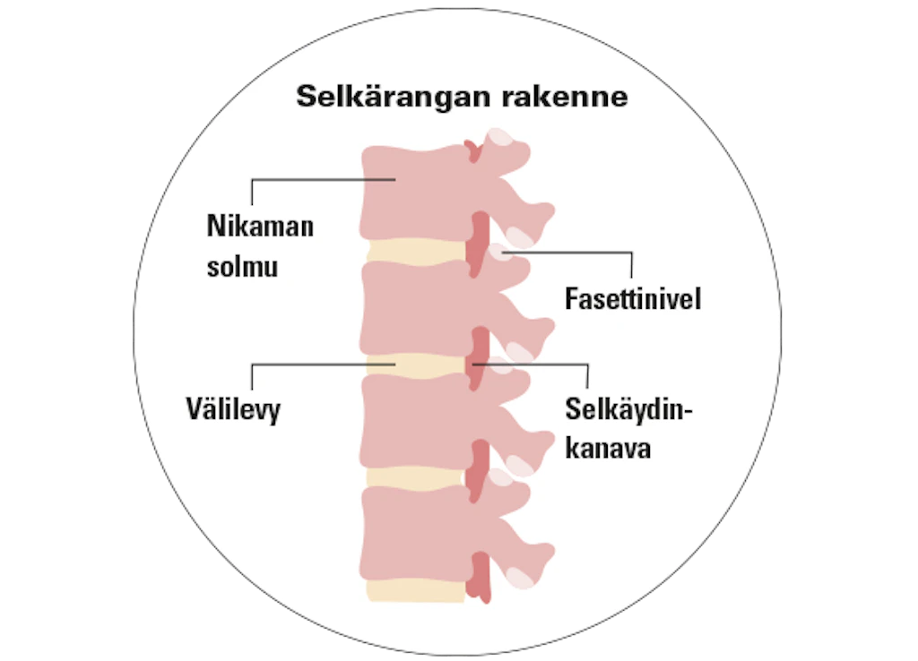 Vaivaako alaselkäkipu? Näin voit päästä alaselkäkivusta! | KUNTO PLUS