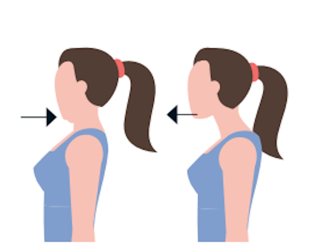 Så här kan du förebygga puckelryggen | I FORM
