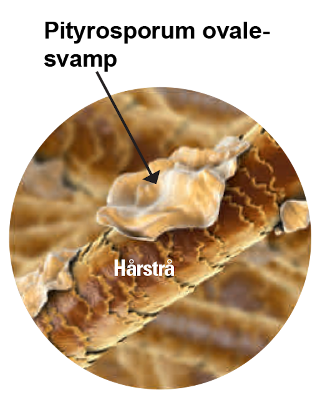 Kløende hovedbund – 5 årsager og lægens bedste råd | I FORM
