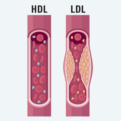 Laske kolesteroliarvojasi liikunnalla | kuntoplus.fi