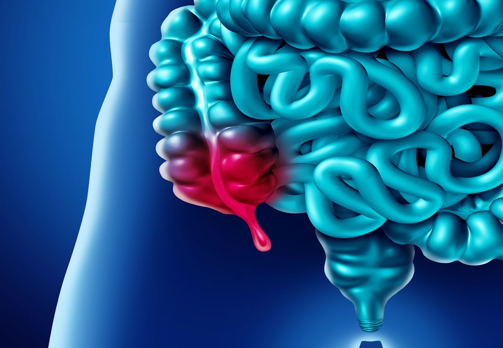 Blindtarmen: Hvilken funktion har blindtarmen? | illvid.dk