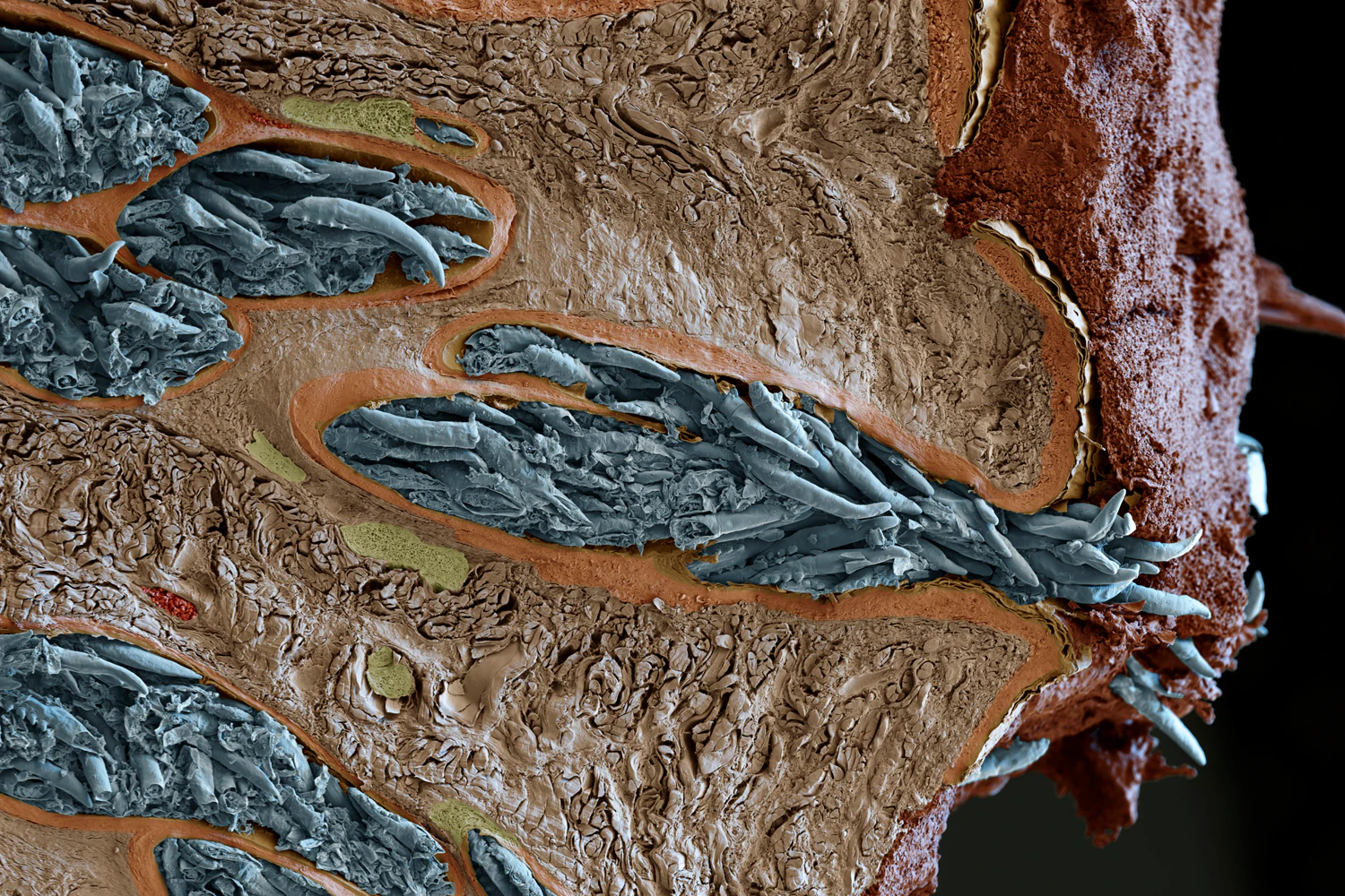 7 parasites that feed on your body | scienceillustrated.com