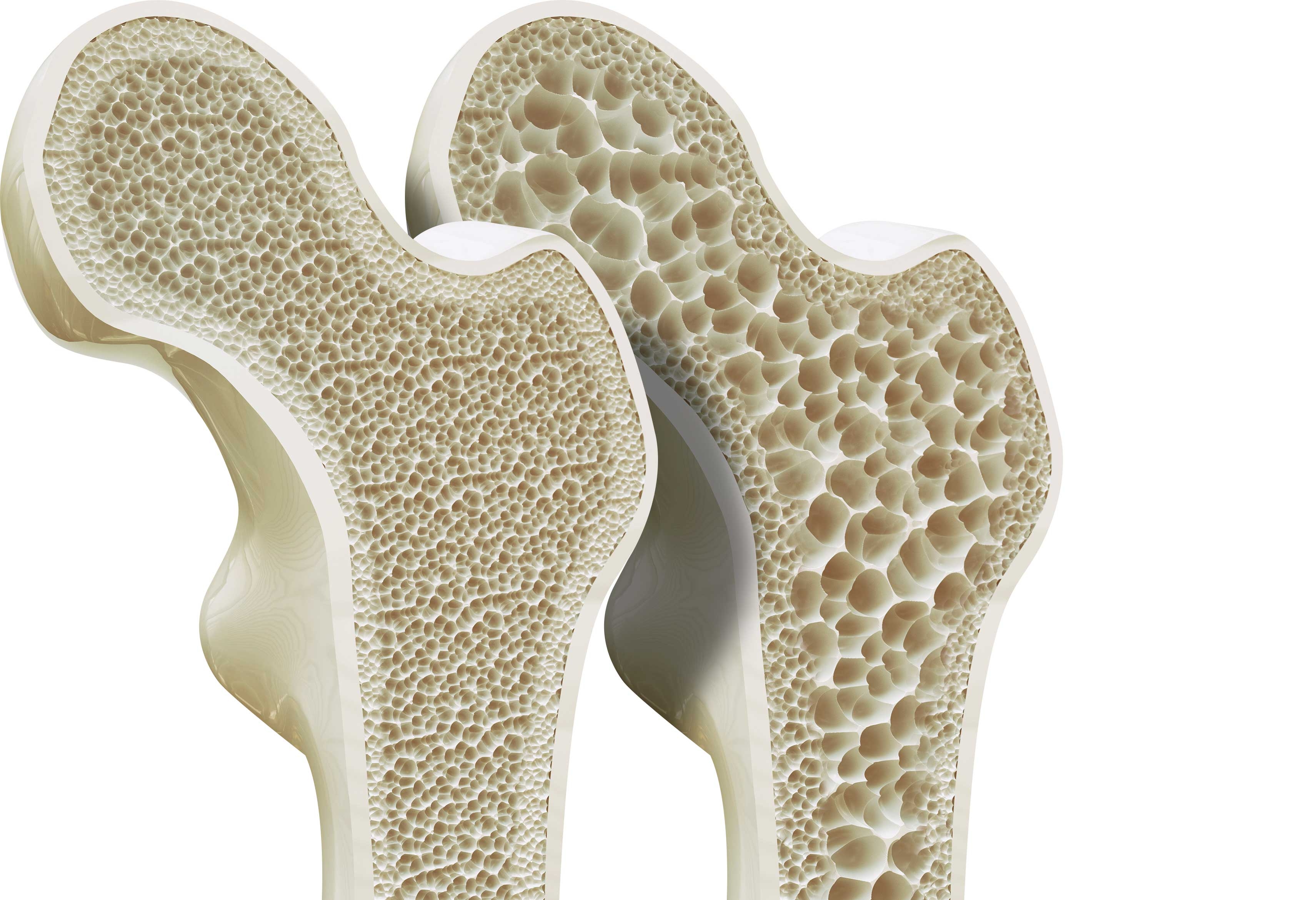 Bot: hoe geneest een botbreuk? | wibnet.nl