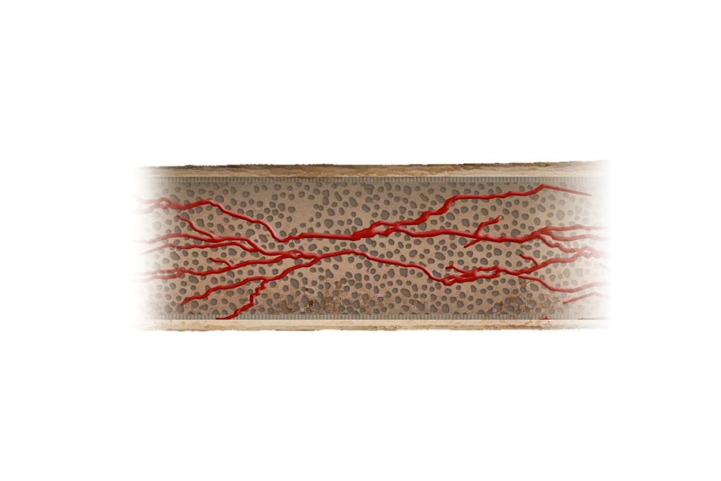 Bot: hoe geneest een botbreuk? | wibnet.nl