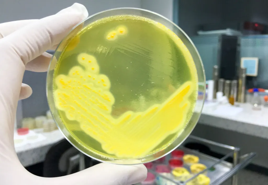Multiresistenta bakterier: Så farliga är de | illvet.se