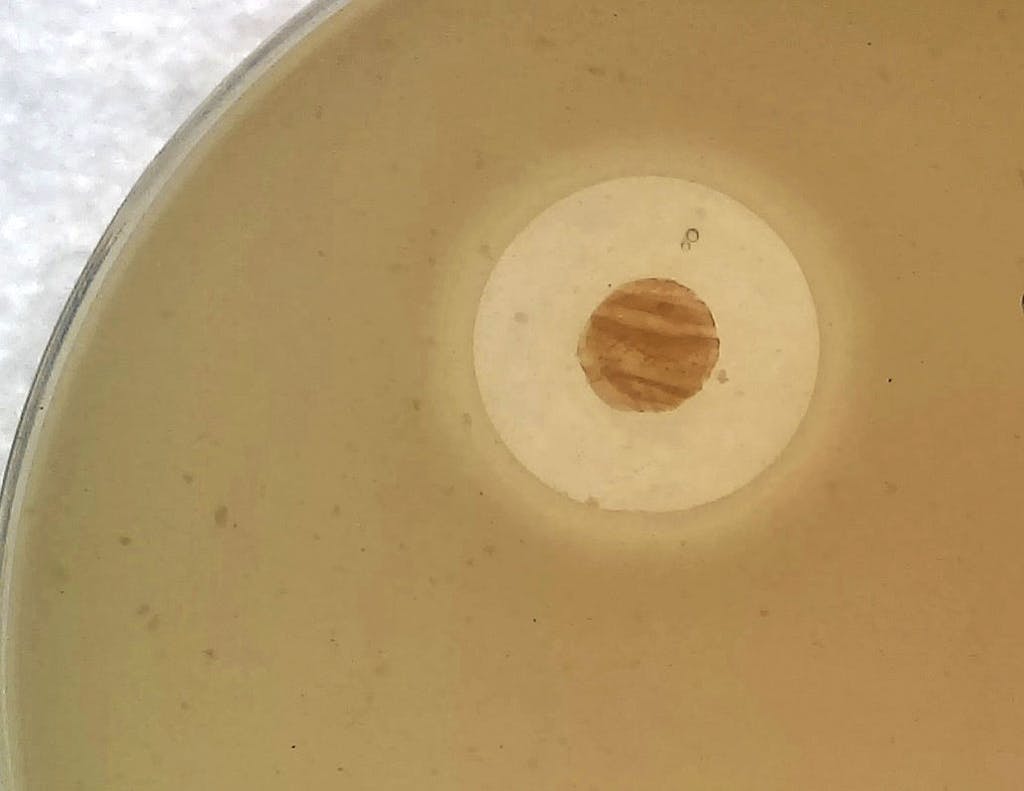 Unohdettu bakteeri voi pelastaa miljoonia | tieku.fi