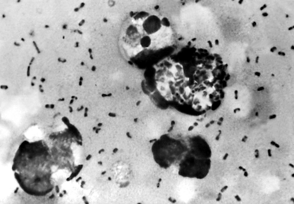 Forskare avslöjar: Här började digerdöden | illvet.se