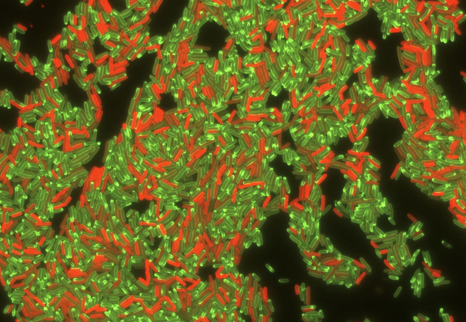 Vleesetende bacteriën kunnen je in een paar uur doden | wibnet.nl