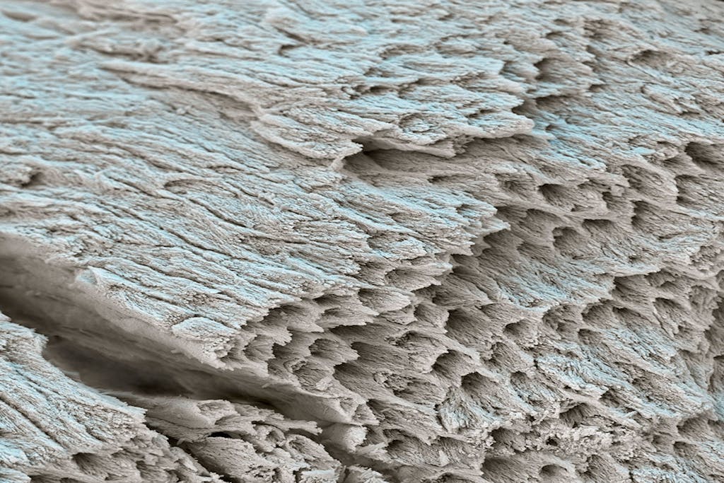 Så lett unngår du gule tenner | illvit.no