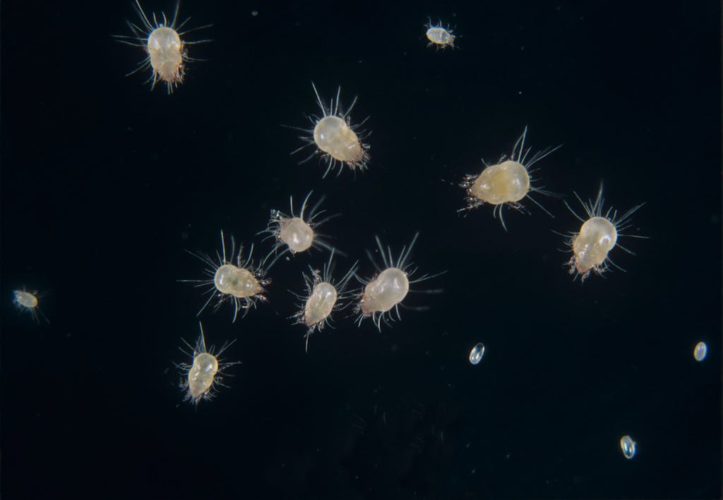 Så lett unngår du gule tenner | illvit.no