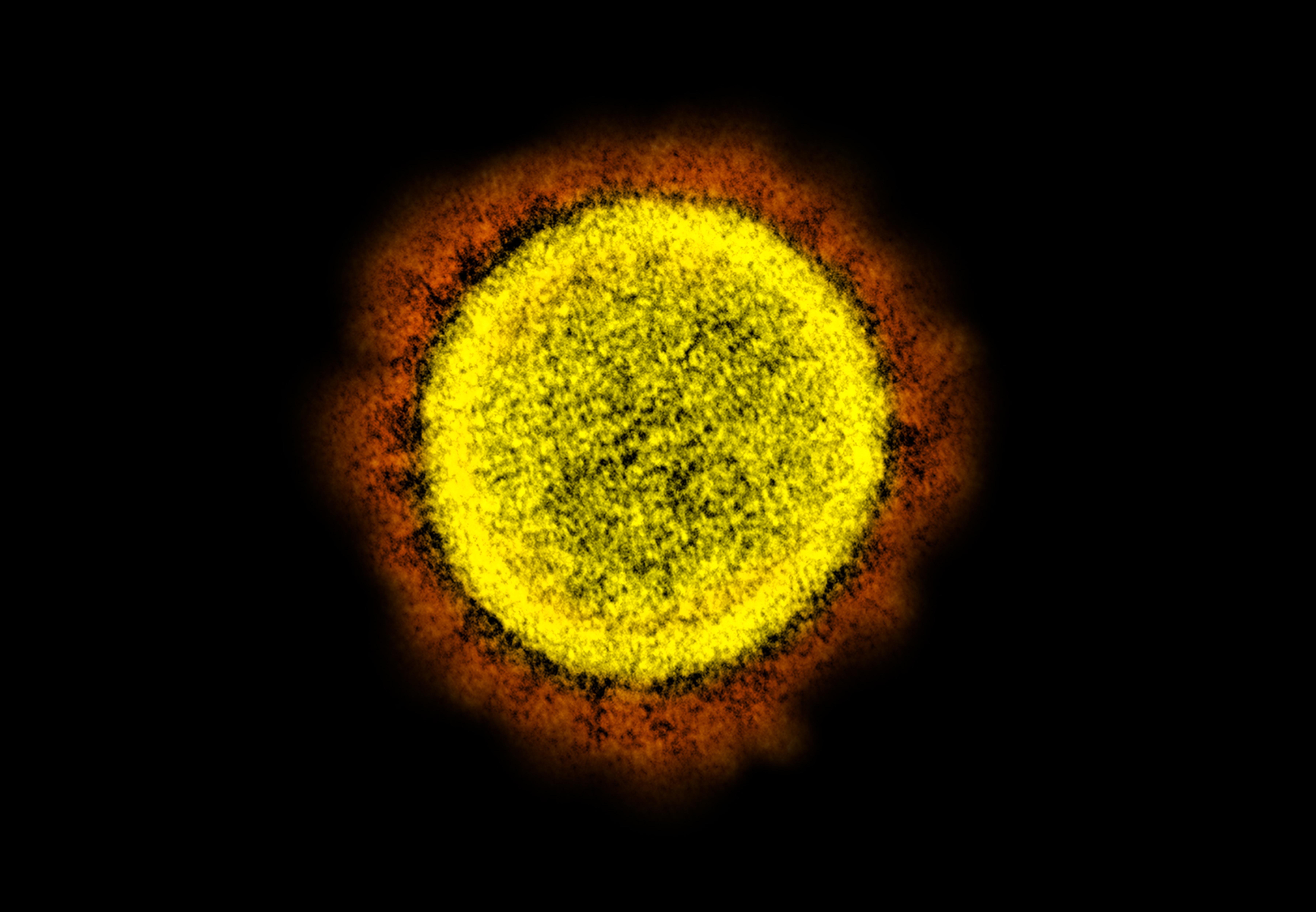 TOPPLISTEN: De mest lovende behandlingene mot Covid-19 | illvit.no