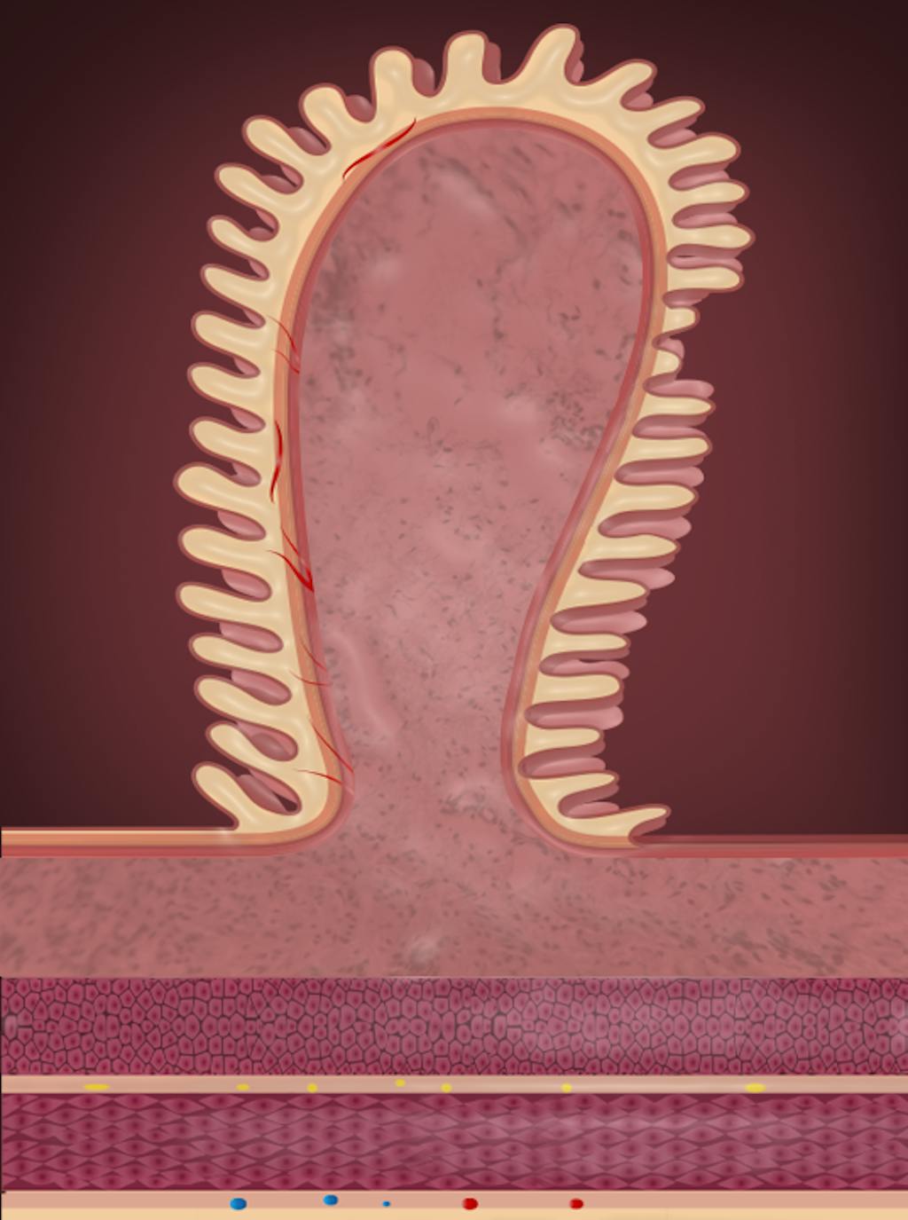 Keliakian salat alkavat paljastua | tieku.fi