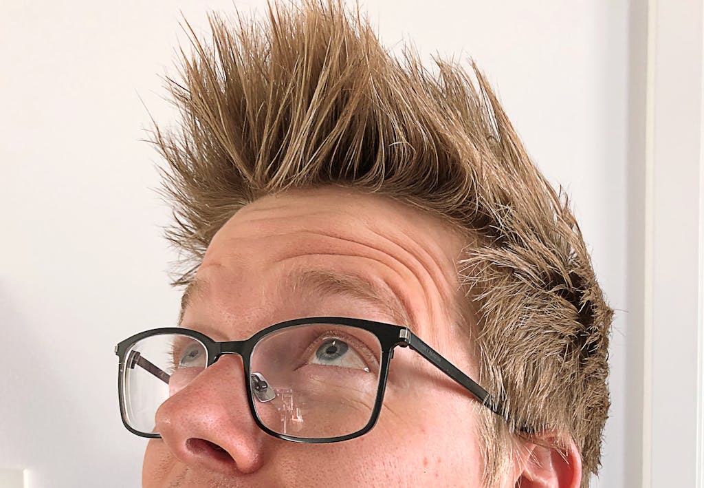 Nieuwe behandeling laat het haar teruggroeien | wibnet.nl