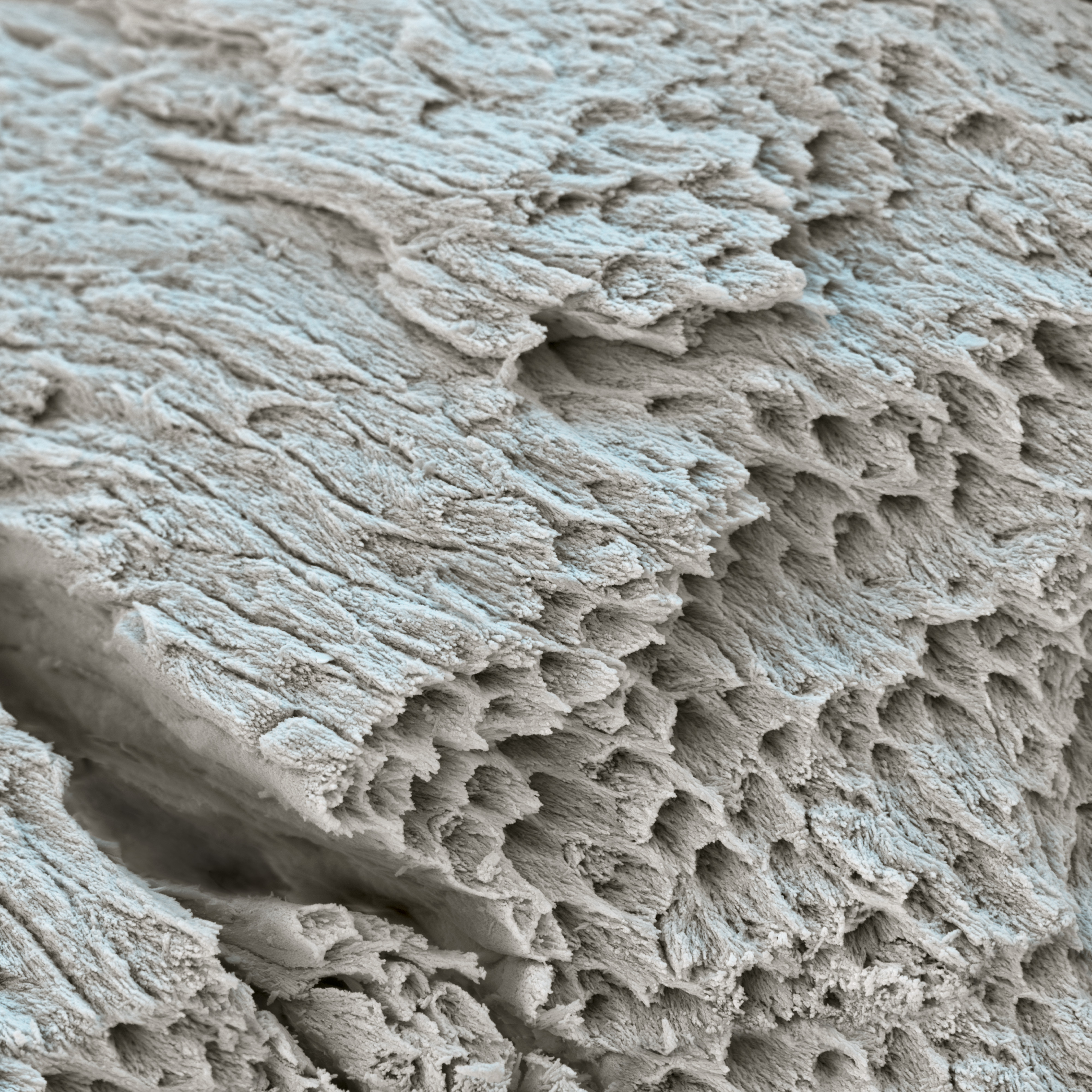 Gule tenner - Slik unngår du dem | illvit.no