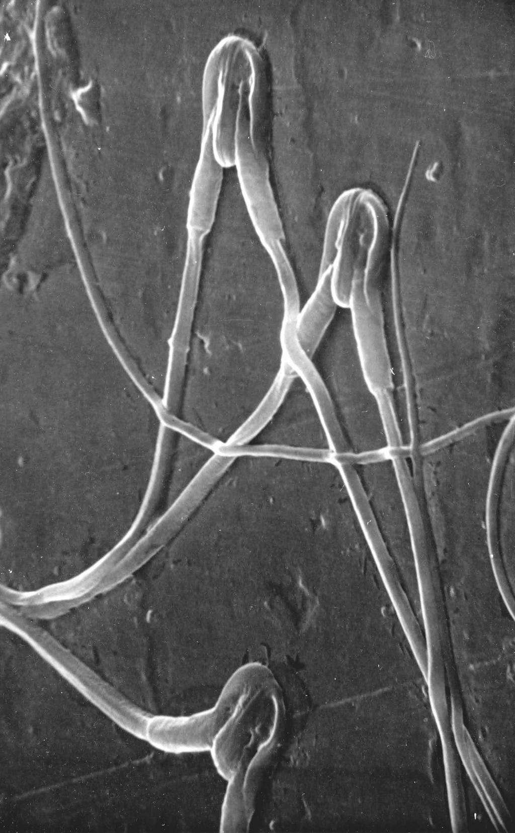 Zaadcellen zetten alle middelen in om de eerste te zijn | wibnet.nl