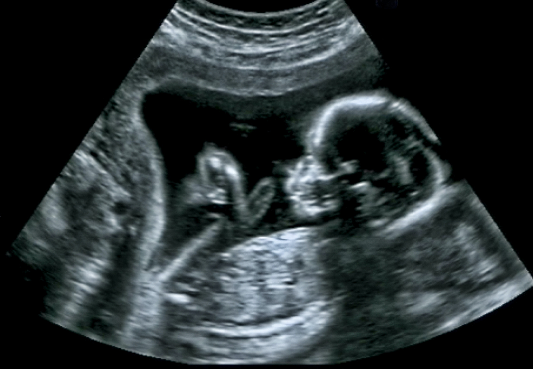 Myte aflivet: Fostre begynder ikke kun som hunkøn | illvid.dk