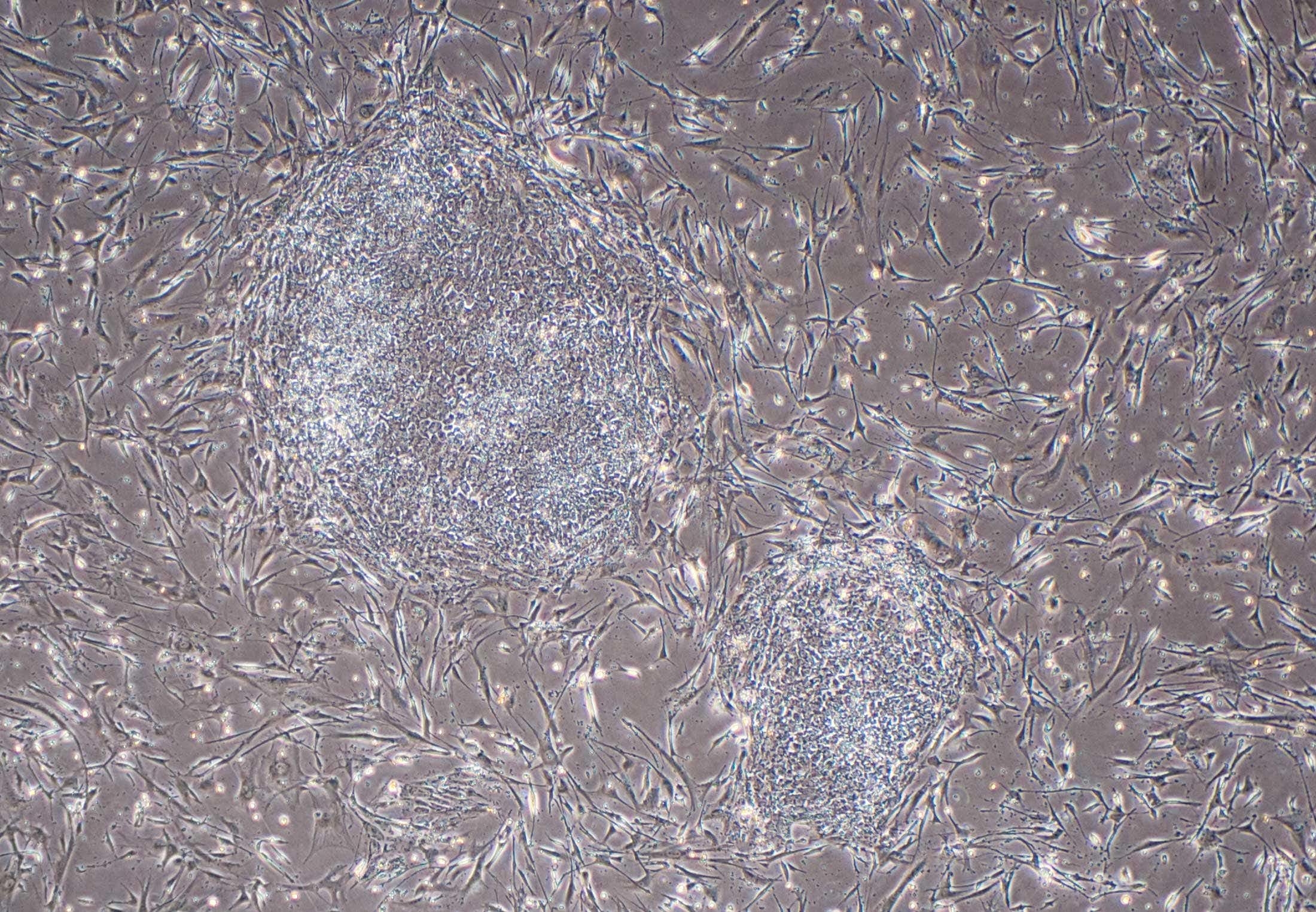 Vad är stamceller? Och vad används de till? | illvet.se