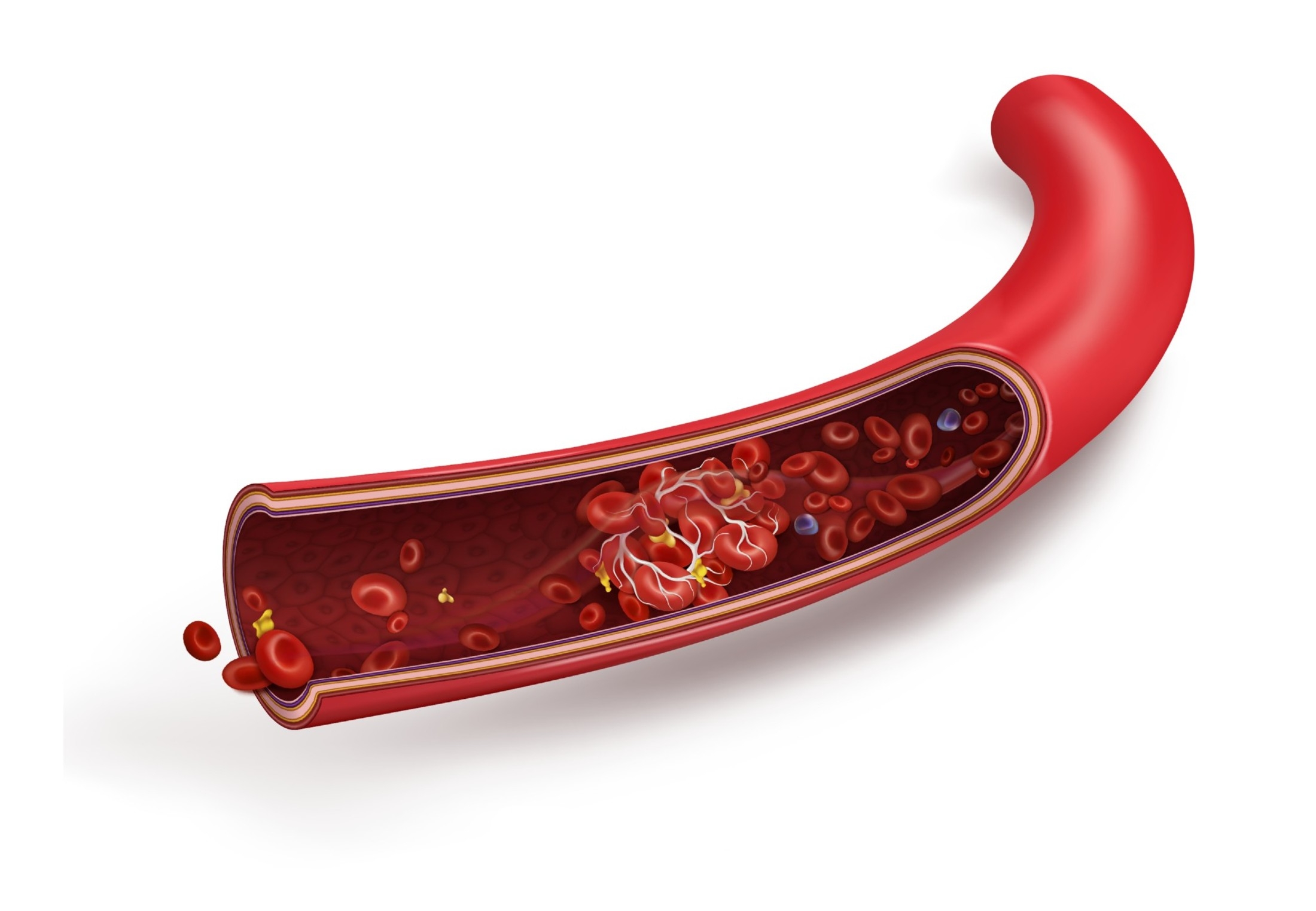 Kolesteroli - Tutkijan neuvot kolesterolin alentamiseen | tieku.fi