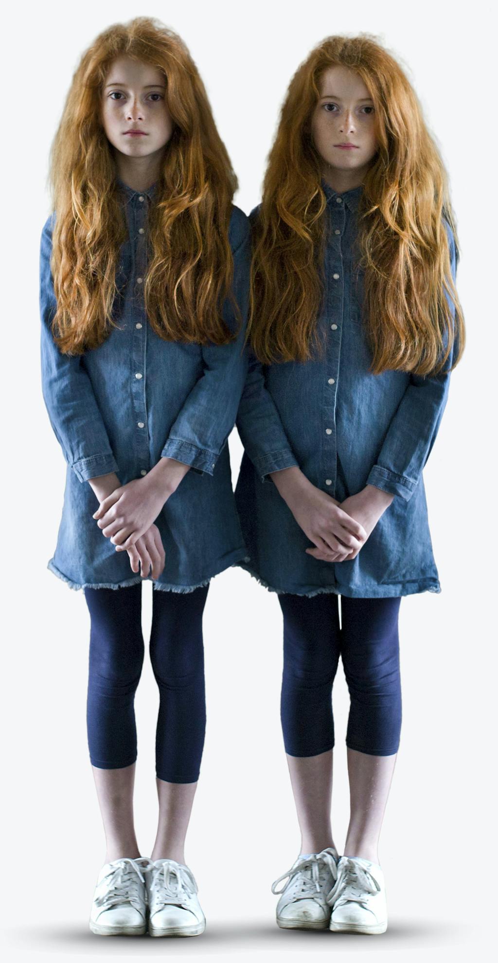 Eeneiige tweelingen zijn niet identiek | wibnet.nl