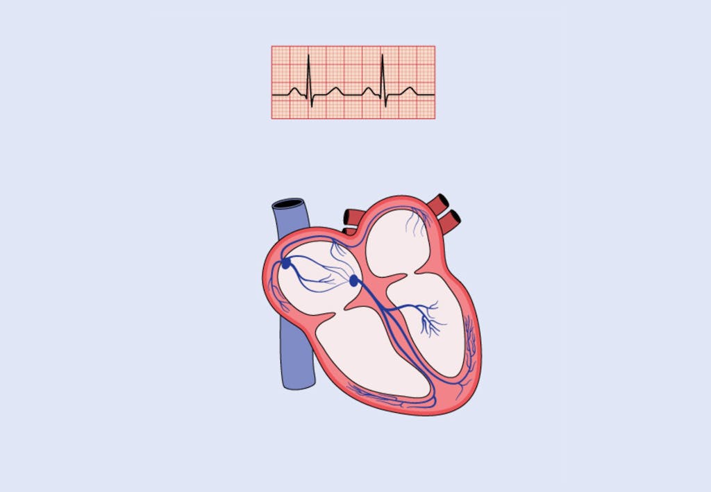Fem myter om hjertestans | illvit.no