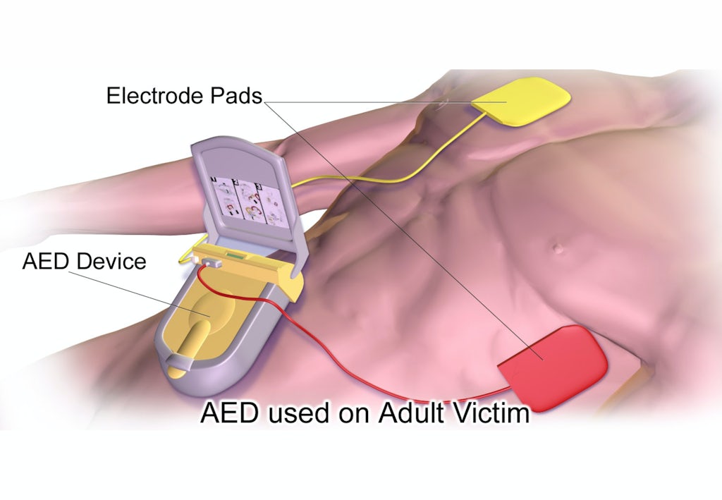 Fem myter om hjertestans | illvit.no