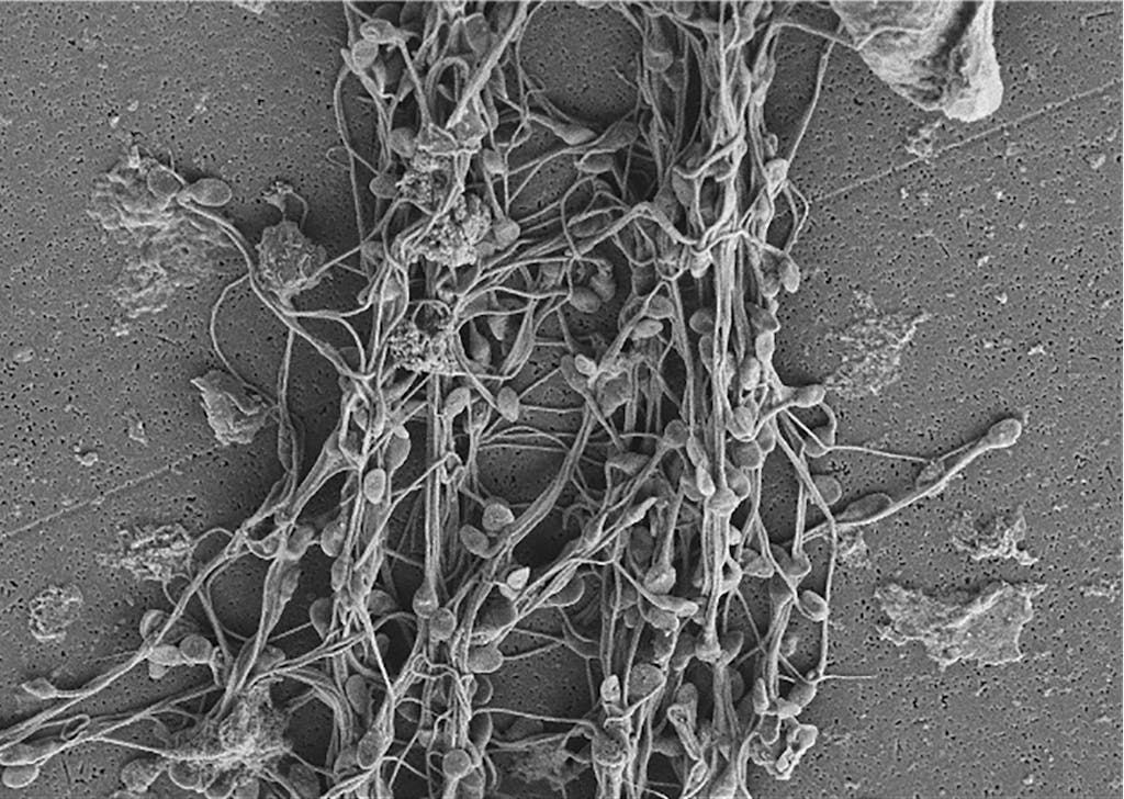 Mogelijk nieuwe anticonceptie zonder hormonen | wibnet.nl