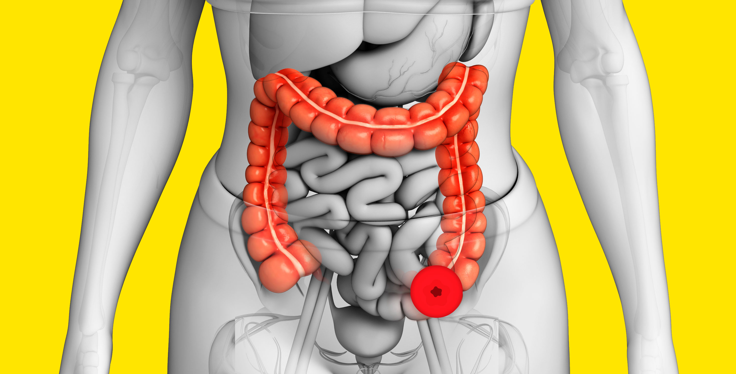 Så fungerar en stomipåse | illvet.se