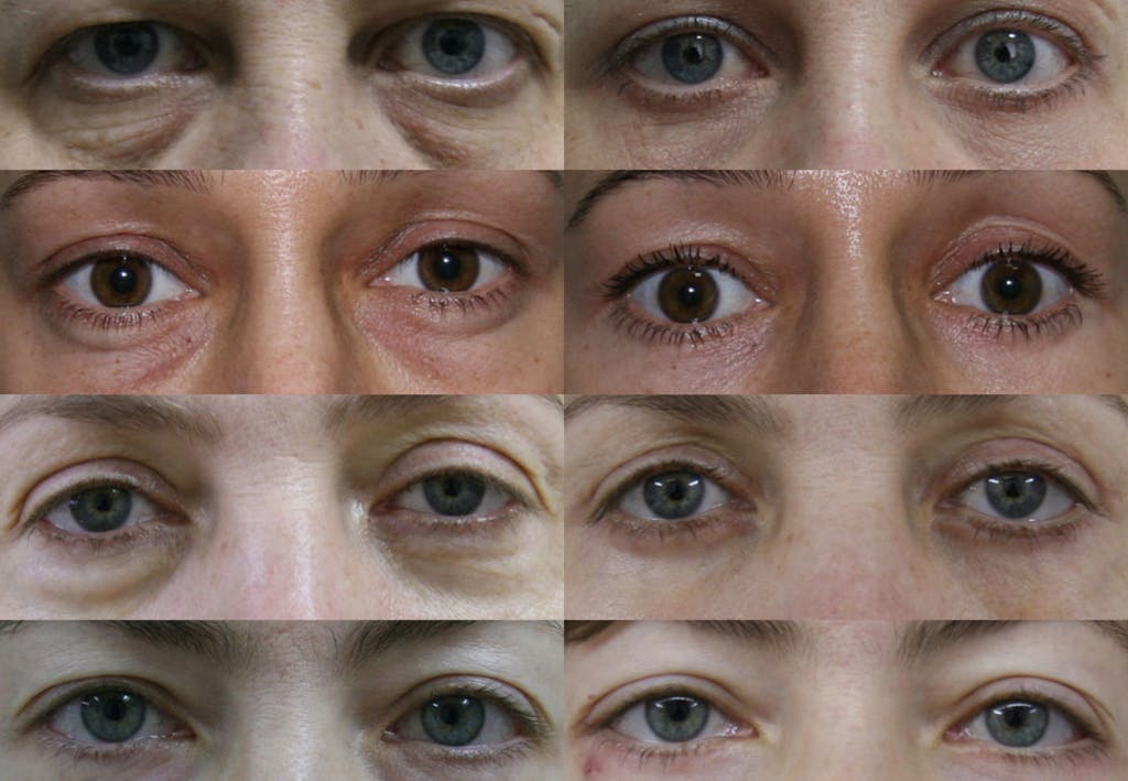 5 vanlige plastiske operasjoner – og hva som kan gå galt | illvit.no