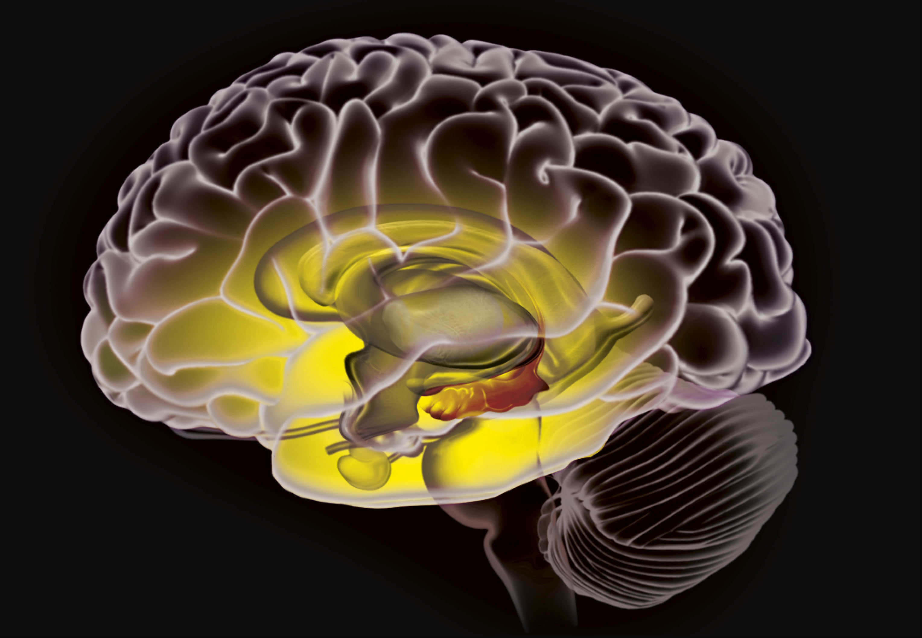 Ratkaisutaistelu Alzheimerin tautia vastaan | tieku.fi