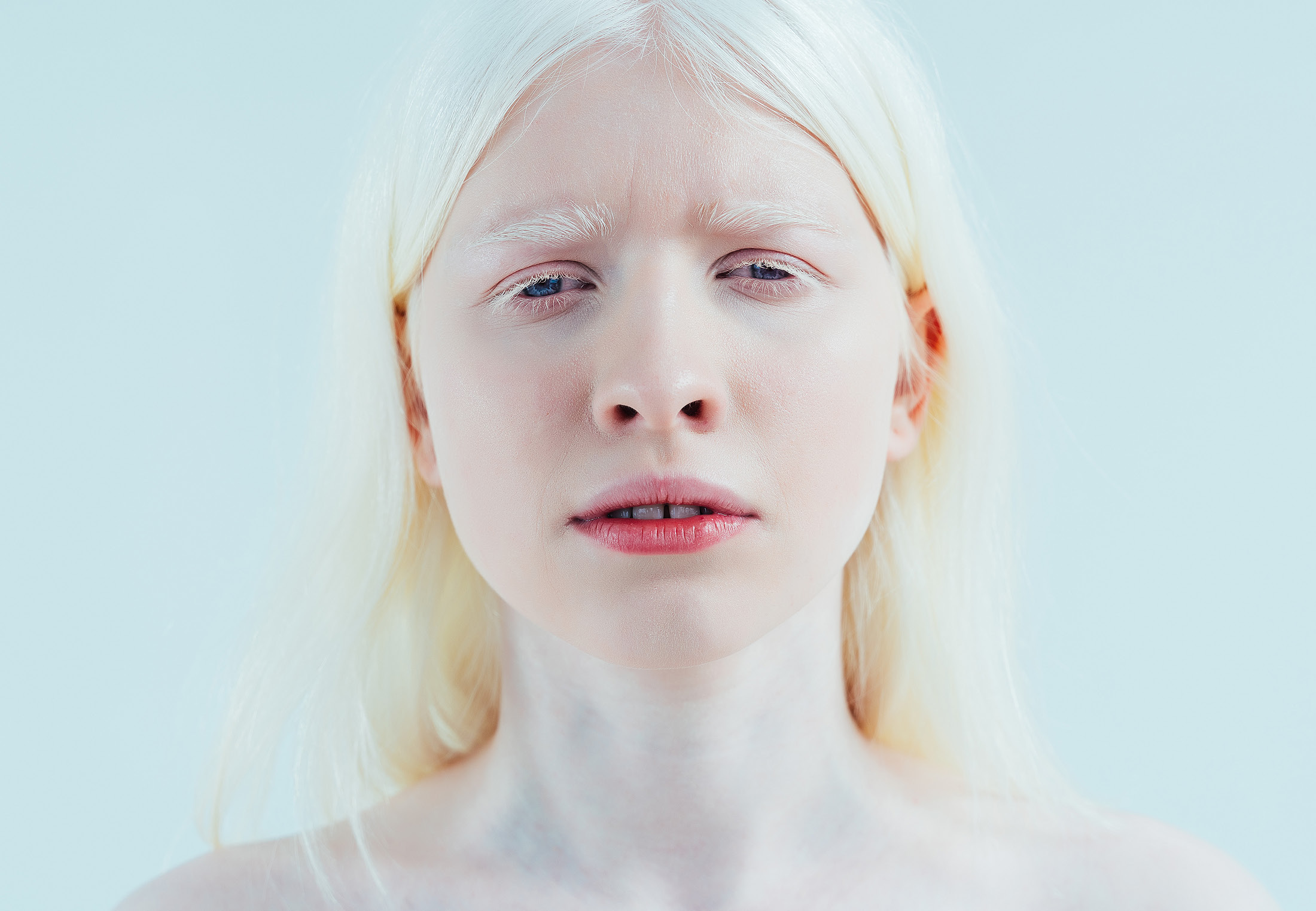Albinisme – albino’s zijn spierwit door genmutatie | wibnet.nl