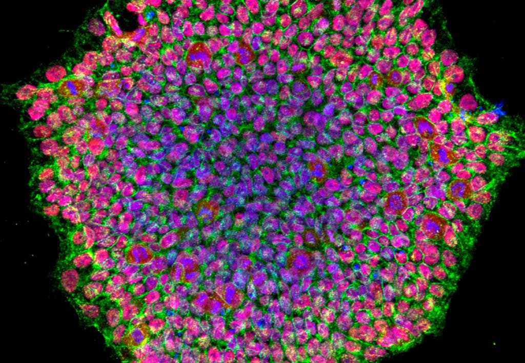 Forskere gjør menneskelige hudceller 30 år yngre | illvit.no