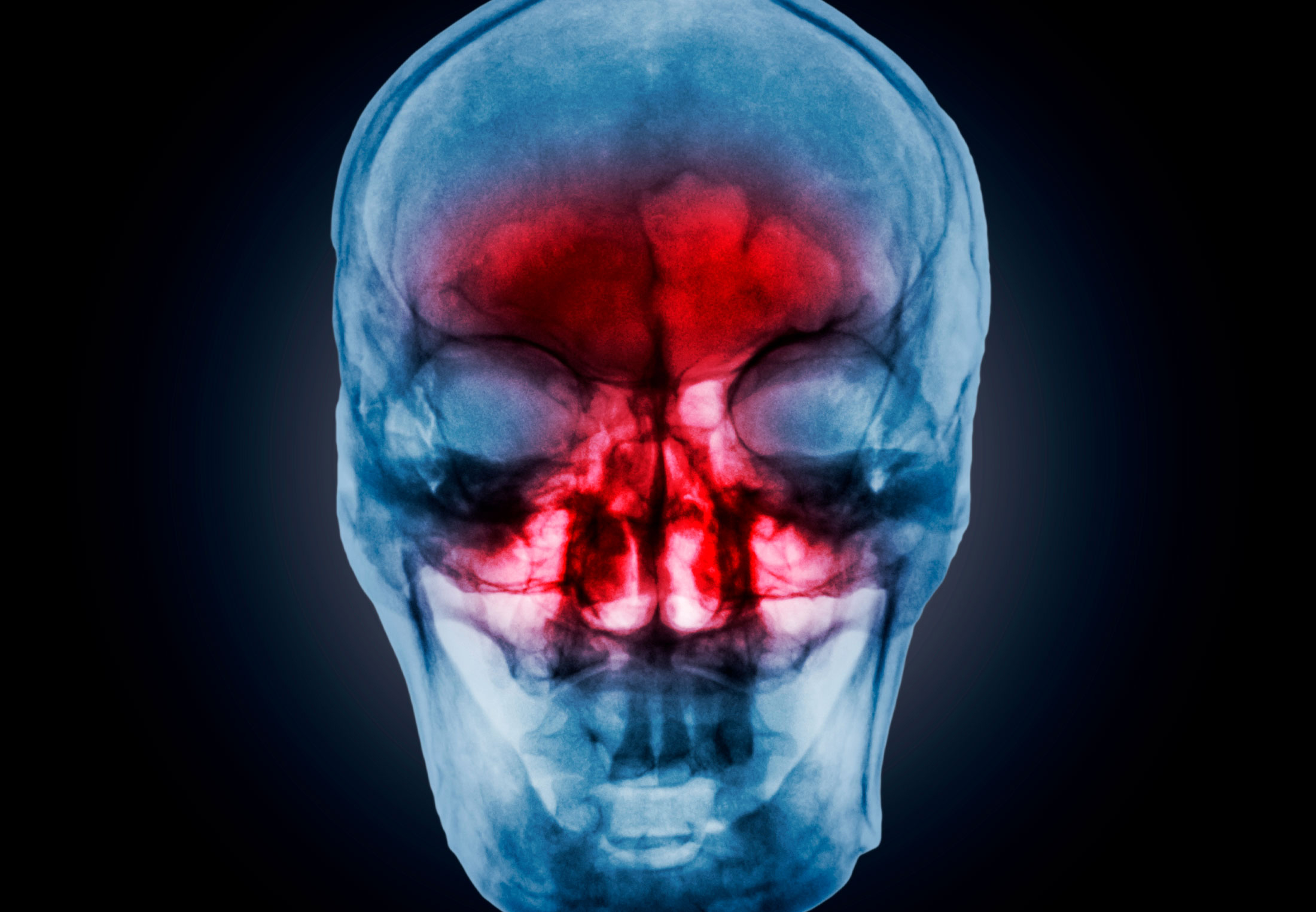 Vad är syftet med bihålorna? | illvet.se