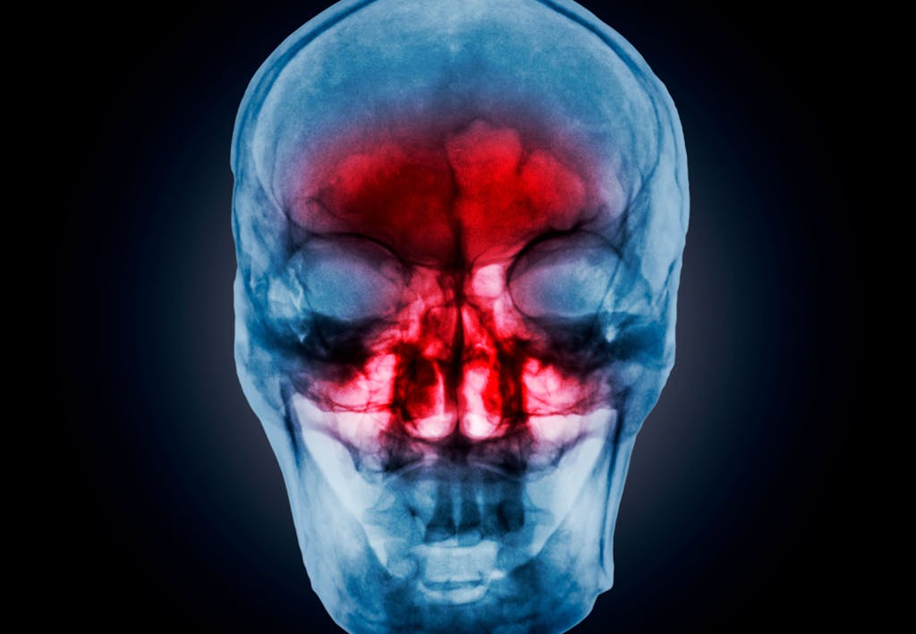 Vad är syftet med bihålorna? | illvet.se